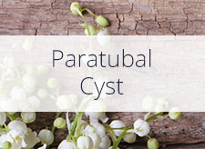Paratubal Cyst | Best Gynecologist Los Angeles Dr. Thais ...