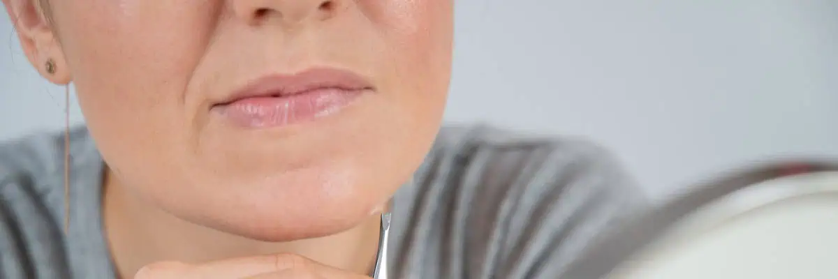 Menopause Unwanted Facial Hair Treatment in Los Angeles